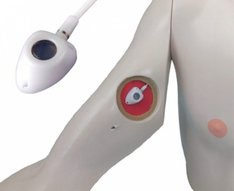 PICC port - Vygon Italia